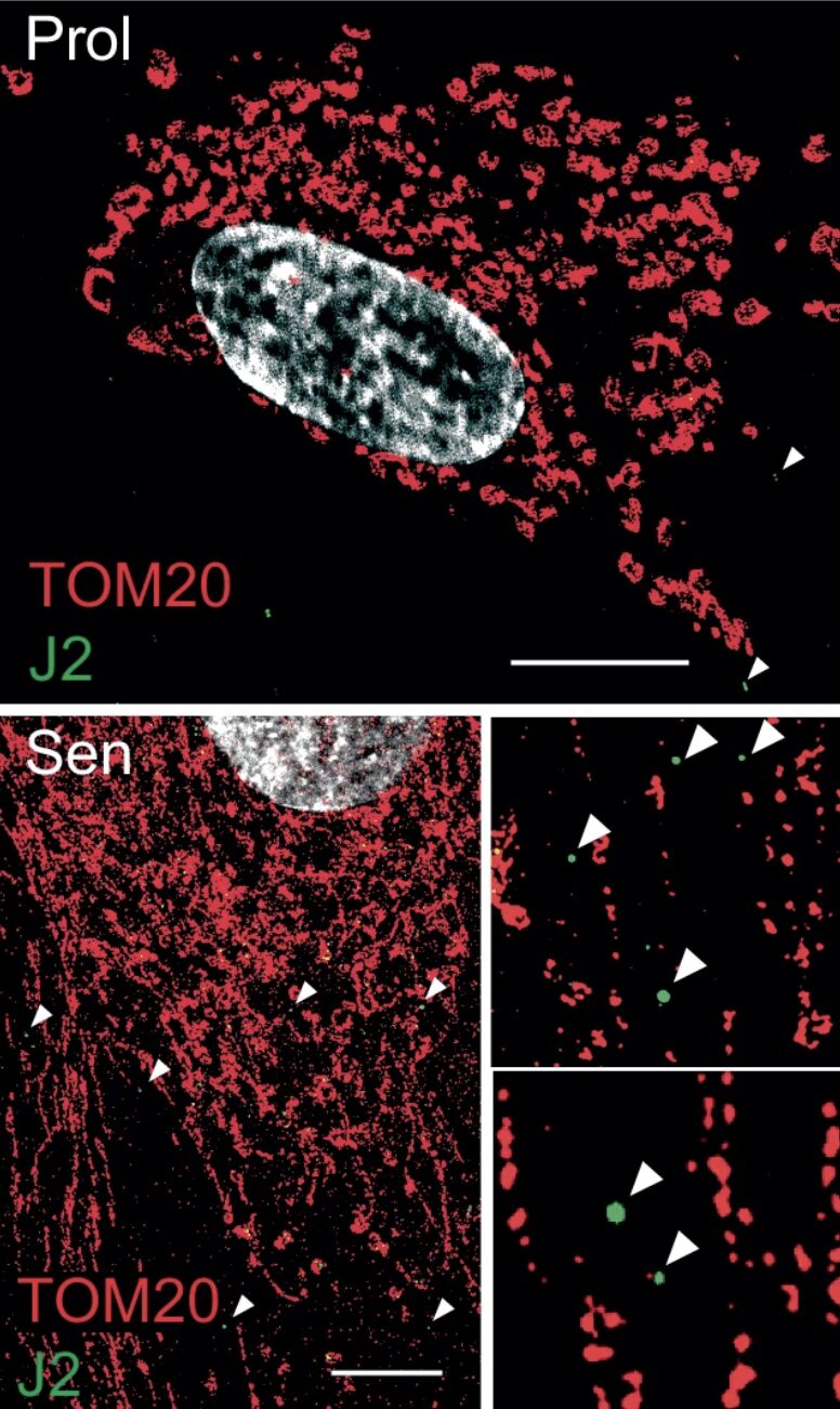A new driver of inflammation in aging: Mitochondrial RNA leakage ...